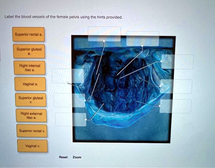 SOLVED: Label the biood vessels of the female pelvis using the hints ...