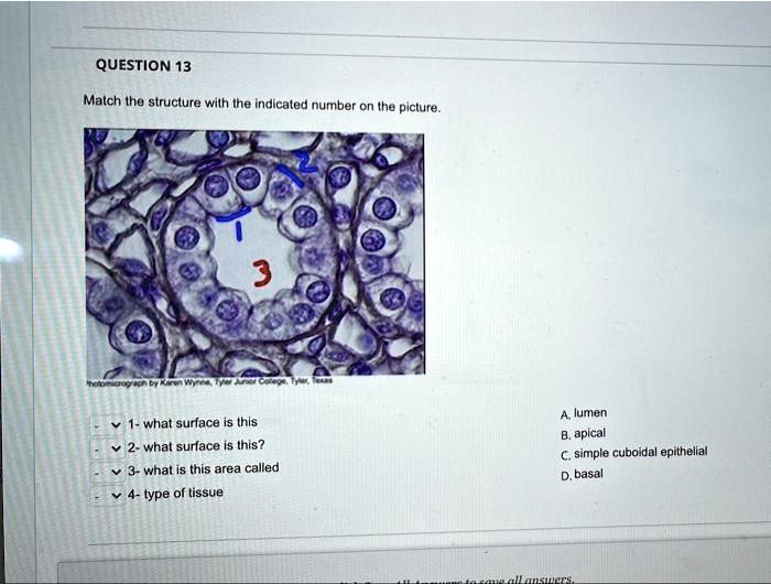 QUESTION 13 Match the structure with the indicated number on the ...