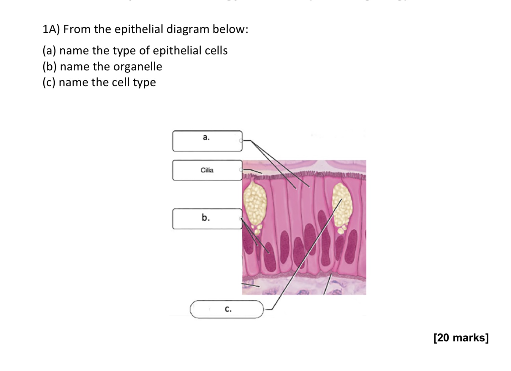 1A) From the epithelial diagram below: (a) name the type of epithelial ...
