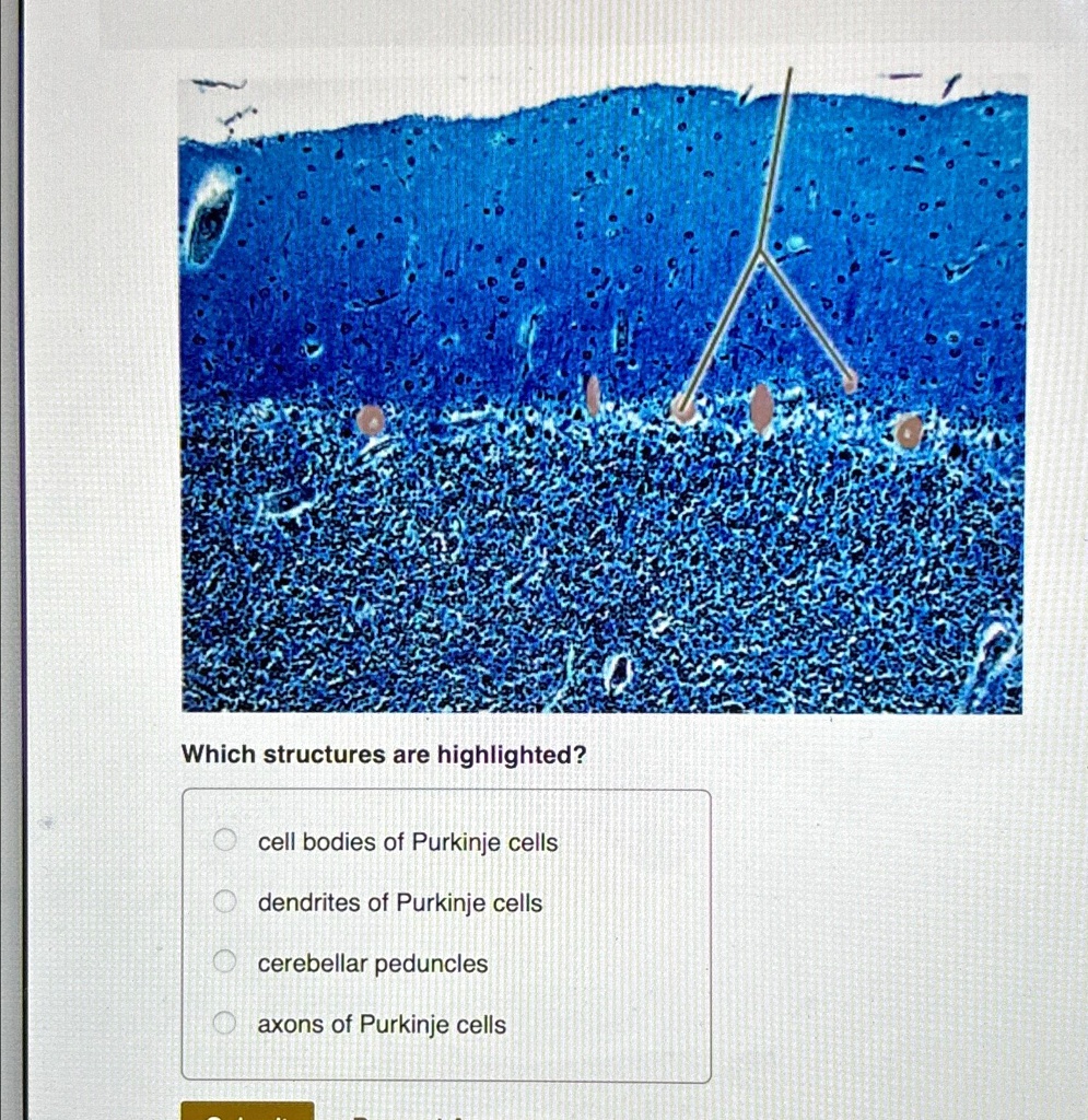 Which structures are highlighted? cell bodies of Purkinje cells ...