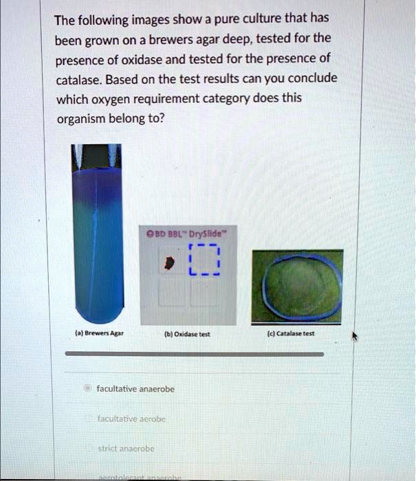 SOLVED: The following images show a pure culture that has been grown on ...