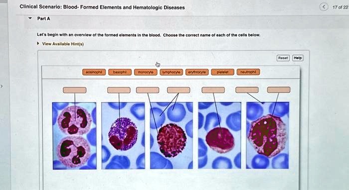 SOLVED: Clinical Scenario: Blood- Formed Elements and Hematologic Diseases Part A Let's begin ...