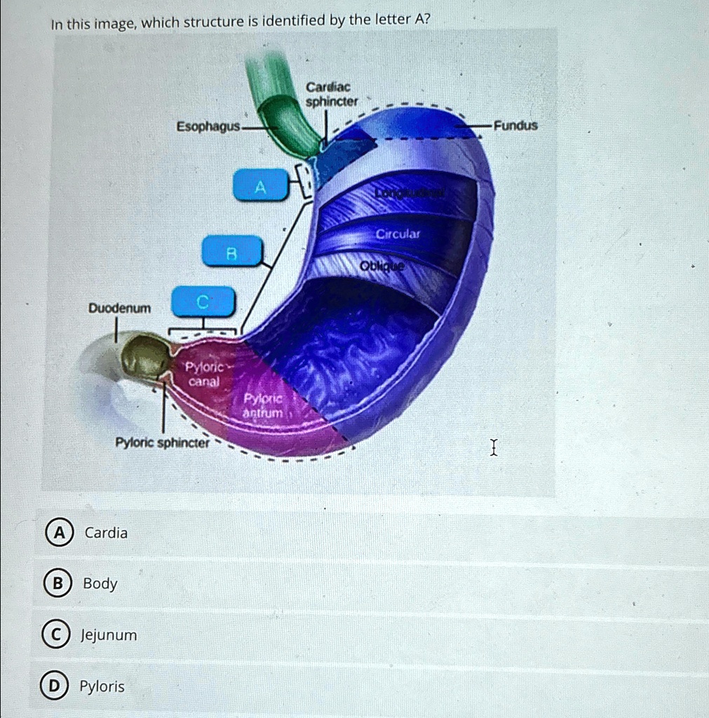 In this image, which structure is identified by the letter A? Duodenum ...