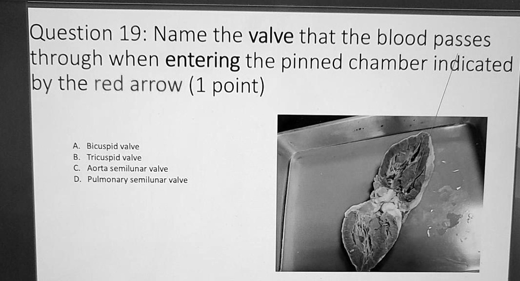 iquestion 19 name the valve that the blood passes through when entering ...