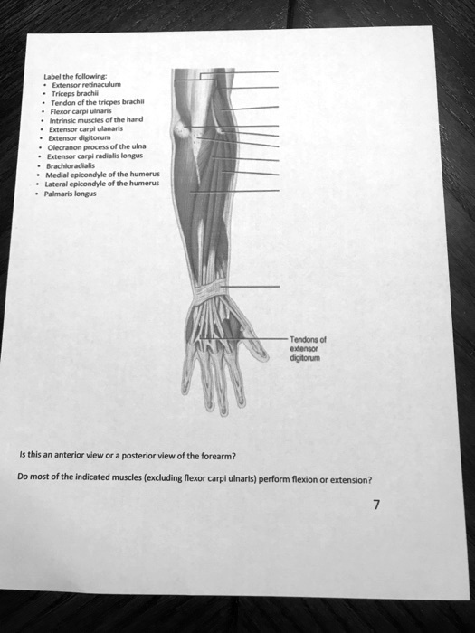 Label the following: • Extensor retinaculum • Triceps brachii • Tendon ...
