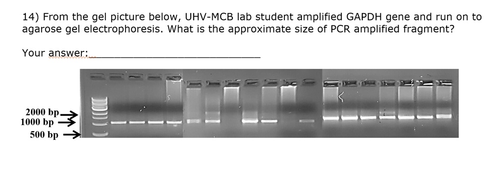 14 from the gel picture below uhv mcb lab student amplified...