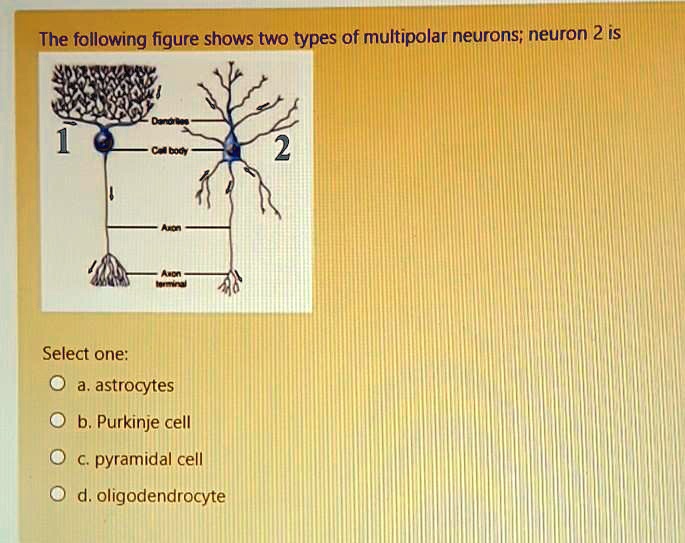 the following figure shows two types of multipolar neurons neuron 2 is ...