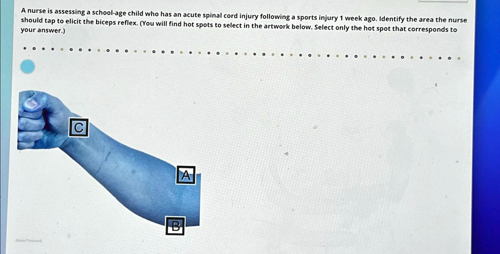 [GET ANSWER] a nurse is assessing a school age child who has an acute ...