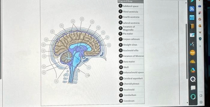 SOLVED: Label Subdural space, third ventricle, fourth ventricle ...