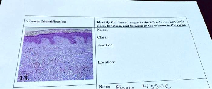 SOLVED: indentify tissue name ,class ,function and location TissuesIdentification Identify the ...