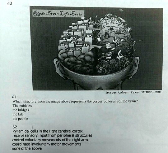 SOLVED: Aigit Brain Lifi Brain [nace taker tcor #IRED CoN Which ...