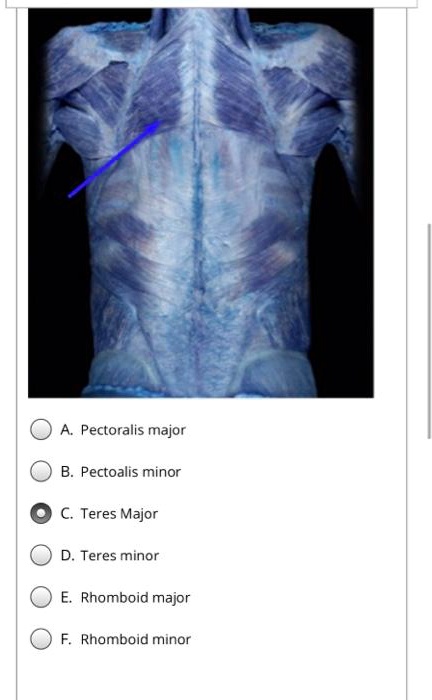 SOLVED: Pectoralis major Pectoalis minor C. Teres Major D. Teres minor ...