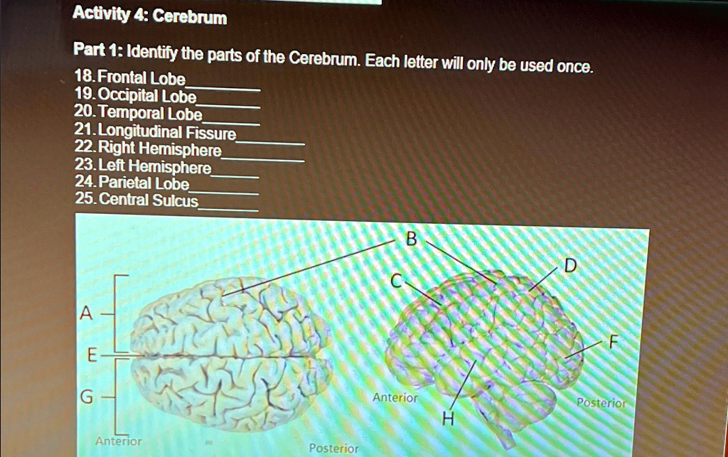 Activity 4: Cerebrum Part 1: Identify the parts of the Cerebrum. Each ...