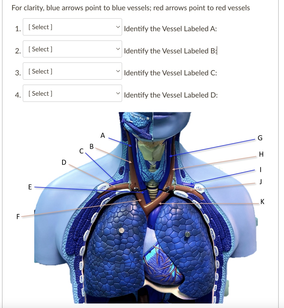 for clarity blue arrows point to blue vessels red arrows point to red ...
