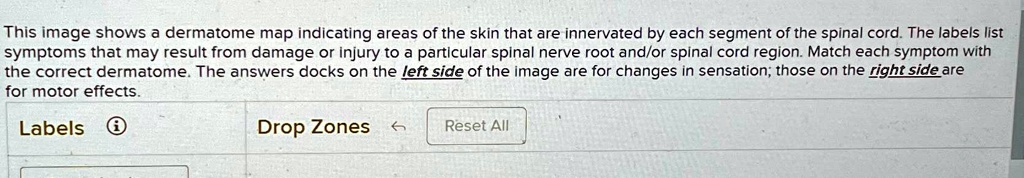 This image shows a dermatome map indicating areas of the skin that are ...