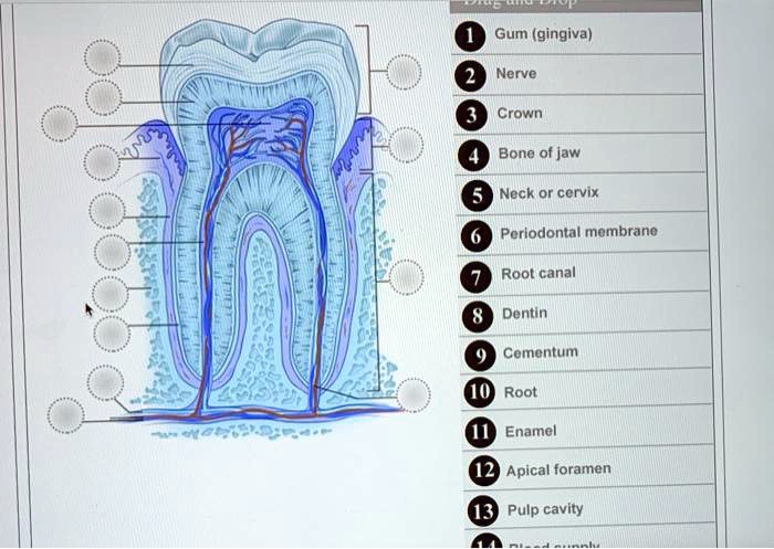 1 Gum (gingiva) 2 Nerve 3 Crown 4 Bone of jaw 5 Neck or cervix 6 ...