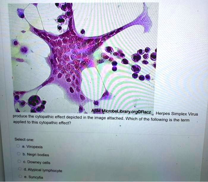 SOLVED: ASM MicrobeLibrary orgoAacz Herpes Simplex Virus produces the ...