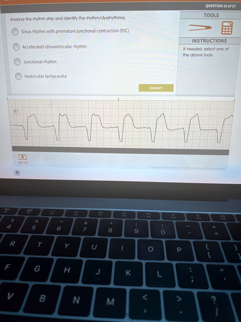 analyze the rhythm strip and identify the rhythmdysrhythmia sinus ...