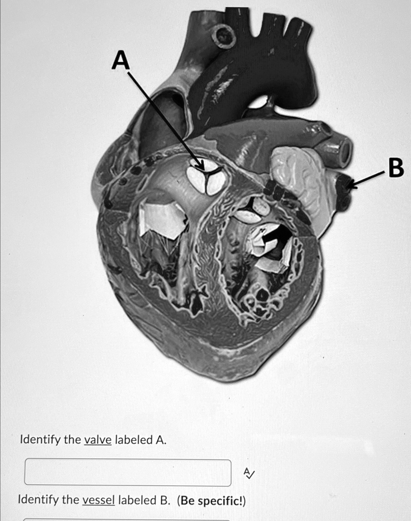 SOLVED: Identify the valve labeled A. A Identify the vessel labeled B ... SOLVED: Identify the valve labeled A. A Identify the vessel labeled B ...