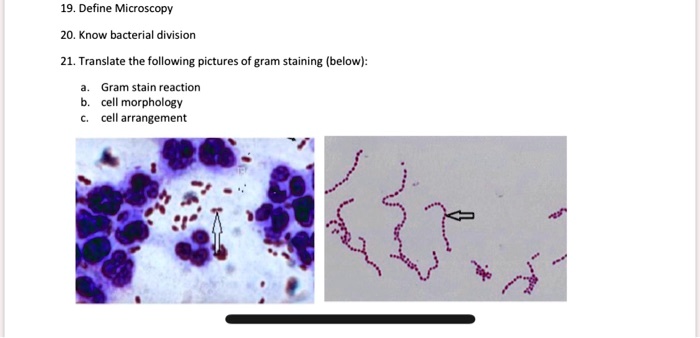 SOLVED: 19. Define Microscopy 20. Know bacterial division 21. Translate ...