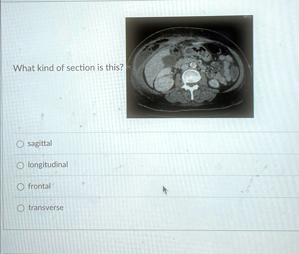SOLVED: What kind of section is this? sagittal longitudinal frontal ...