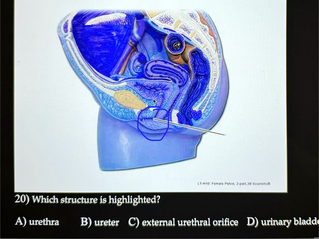 LT-H10: Female Pelvis, 2-part 3B Scientific 20) Which structure is highlighted? A) urethra B ...