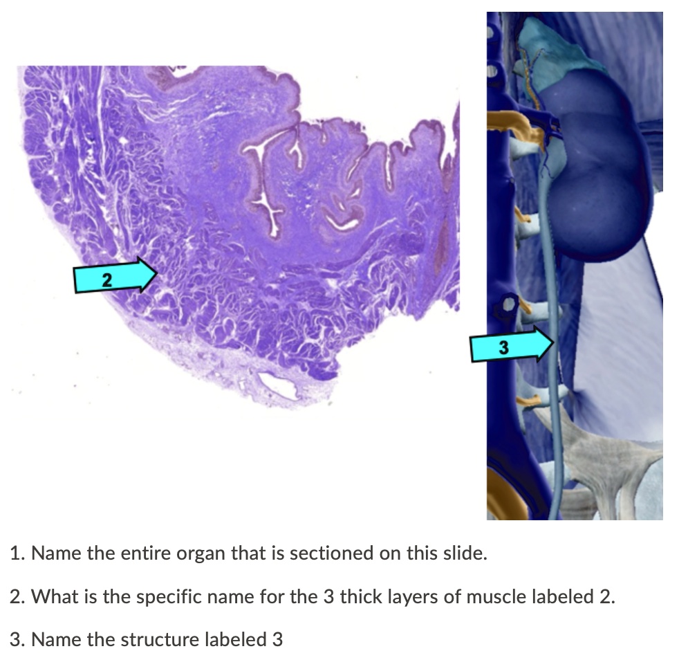 1. Name the entire organ that is sectioned on this slide. 2. What is ...