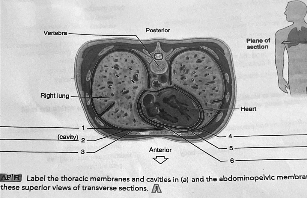 Posterior Vertebra Plane of section Right lung 1 (cavity) 2 3 Anterior ...