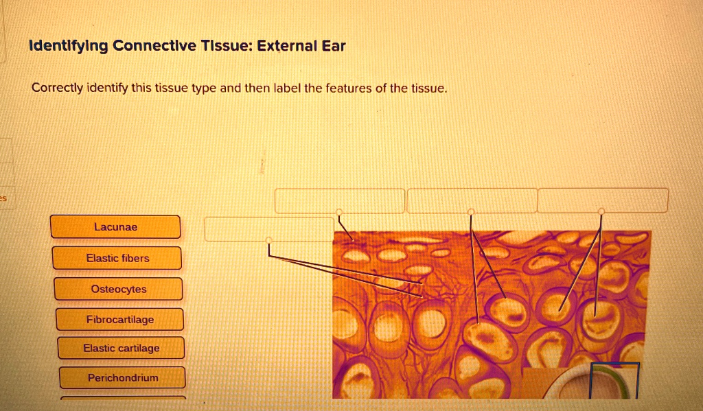 Identifying Connective Tissue: External Ear Correctly identify this ...