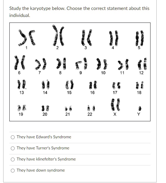 Study the karyotype below. Choose the correct statement about this ...