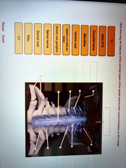 Click and drag the features of the cervical region of the spinal cord ...