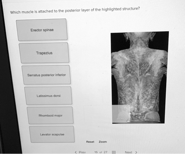 SOLVED: Which muscle is attached to the posterior layer of the ...