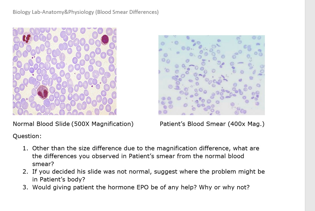 SOLVED: Biology Lab - Anatomy Physiology (Blood Smear Differences ...