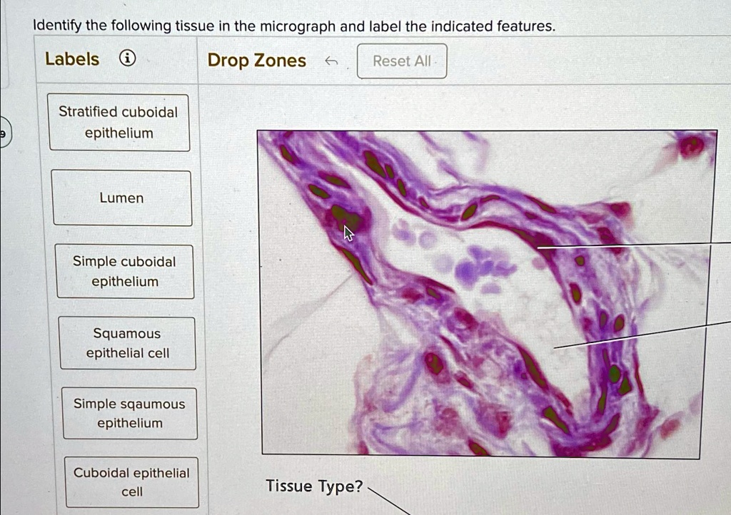Identify the following tissue in the micrograph and label the indicated ...