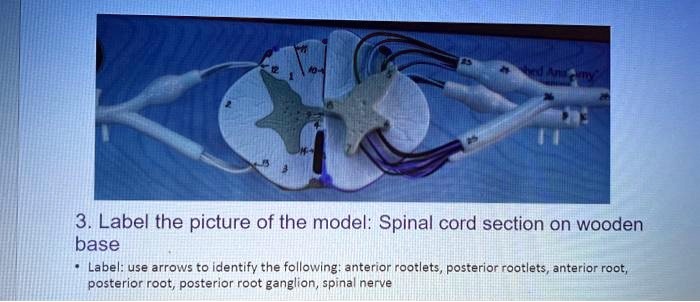 3. Label the picture of the model: Spinal cord section on...