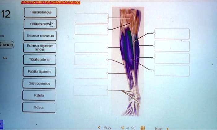 12 Correctly label the muscles of the leg Fibularis longus Fibularis ...
