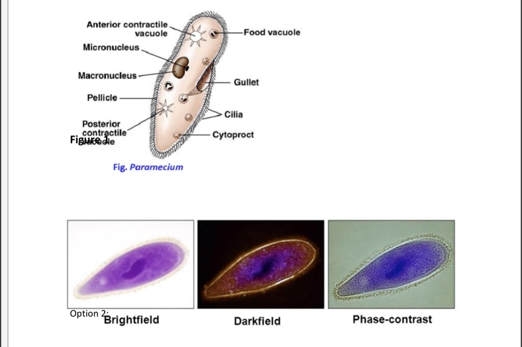 SOLVED: Question 1: This is looking at the structure of a paramecium ...