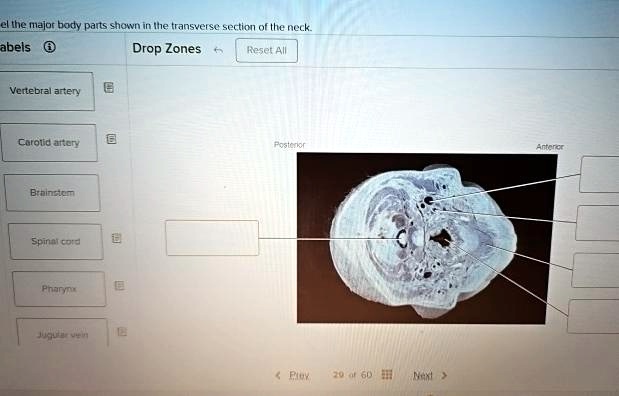 el the major body parts shown in the transverse section of the neck ...