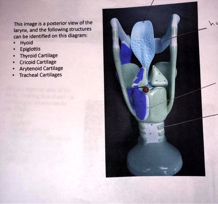 This image is a posterior view of the larynx, and the following ...