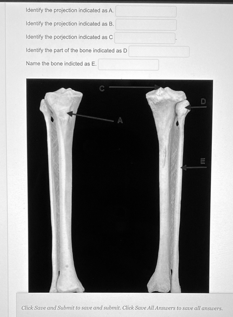 VIDEO solution: Identify the projection indicated as A. Identify the projection indicated as B ...