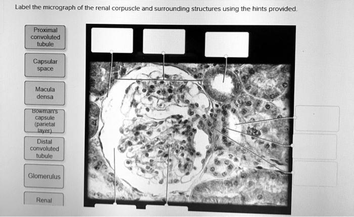 SOLVED: Label the micrograph of the renal corpuscle and surrounding ...