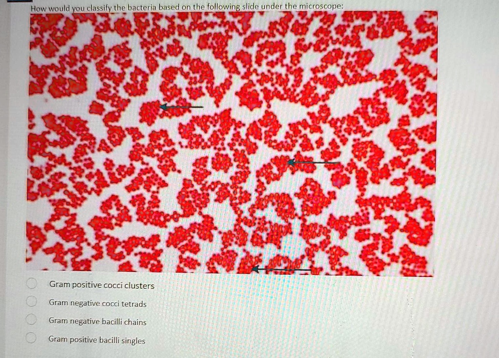 How would you classify the bacteria based on the following slide under the microscope: Gram ...