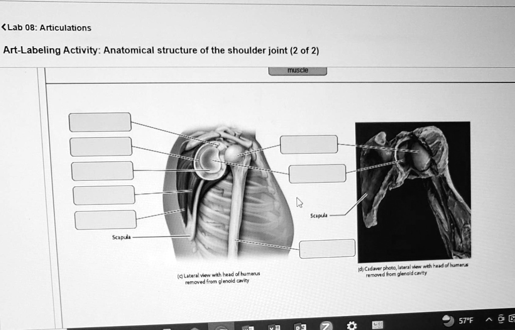 Lab 08: Articulations Art-Labeling Activity: Anatomical...
