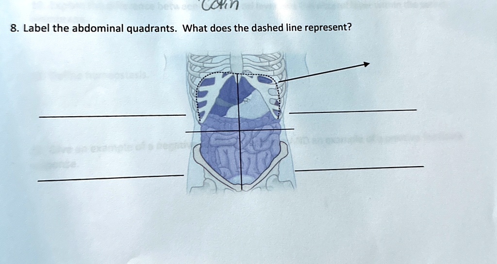 8. Label the abdominal quadrants. What does the dashed line represent?