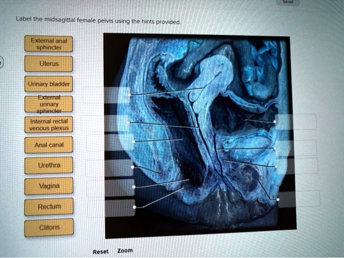SOLVED: Label the midsagittal female pelvis using the hints provided ...