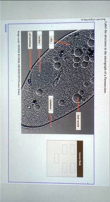 SOLVED: Texts: Label the structures in the micrograph of a Paramecium ...