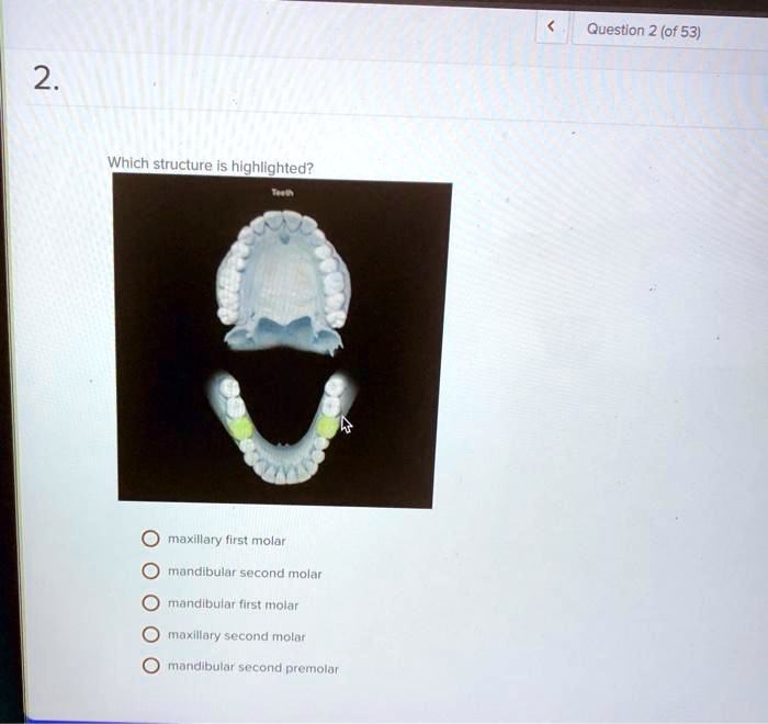 2. Which structure is highlighted? Teeth maxillary first...