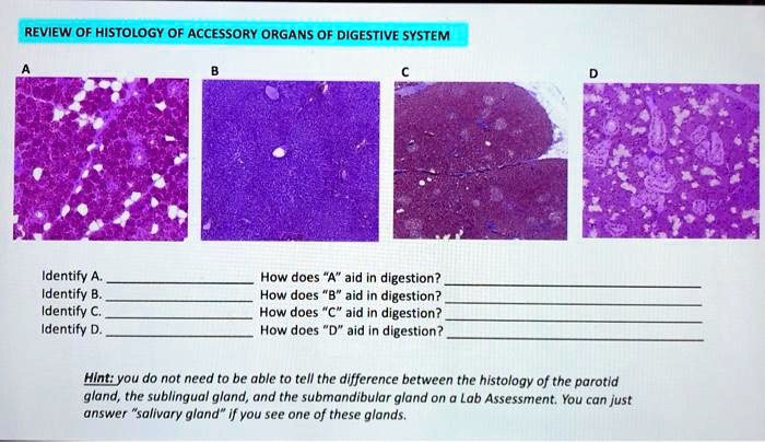 REVIEW OF HISTOLOGY OF ACCESSORY ORGANS OF DIGESTIVE SYSTEM A B C D ...