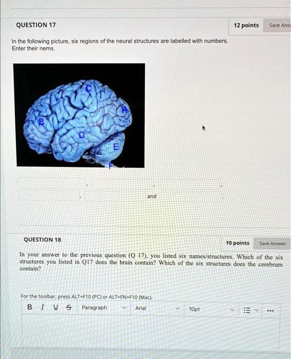 QUESTION 17 In the following picture, six regions of the neural ...