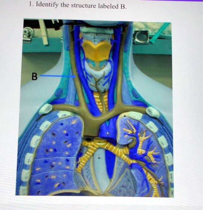 SOLVED: 1. Identify the structure labeled B. B